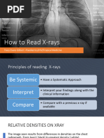 Chest X-Ray Abnormalities - Costophrenic Angle Blunting | PDF | Radiology | Lung