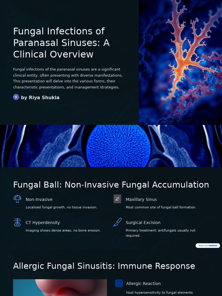 Fungal Sinus Infections: Overview & Types | PDF