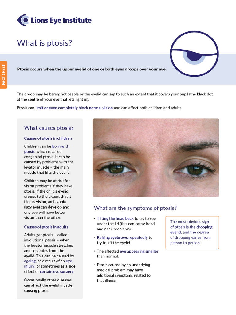 Ptosis Fact-Sheet A4 Jun21 v2 | PDF | Human Diseases And Disorders | Ophthalmology