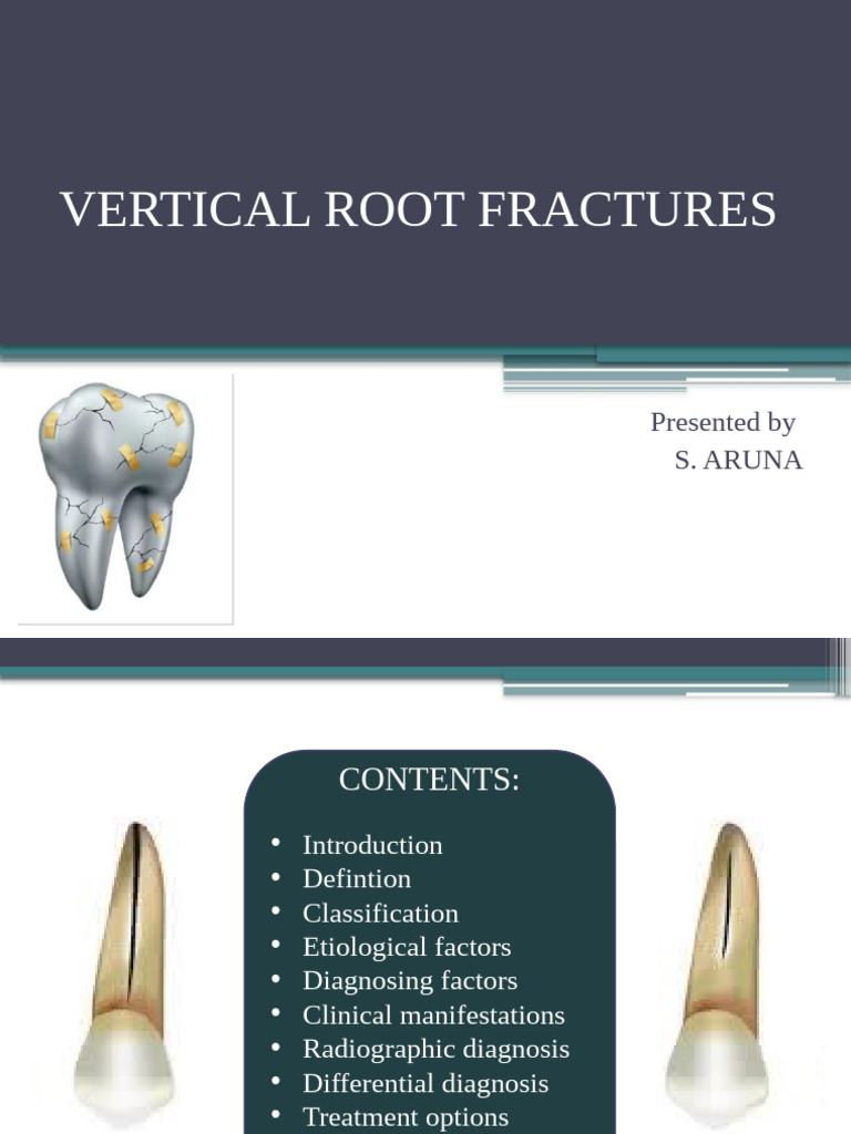 Vertical Root Fractures | PDF | Dental Anatomy | Dentistry Branches