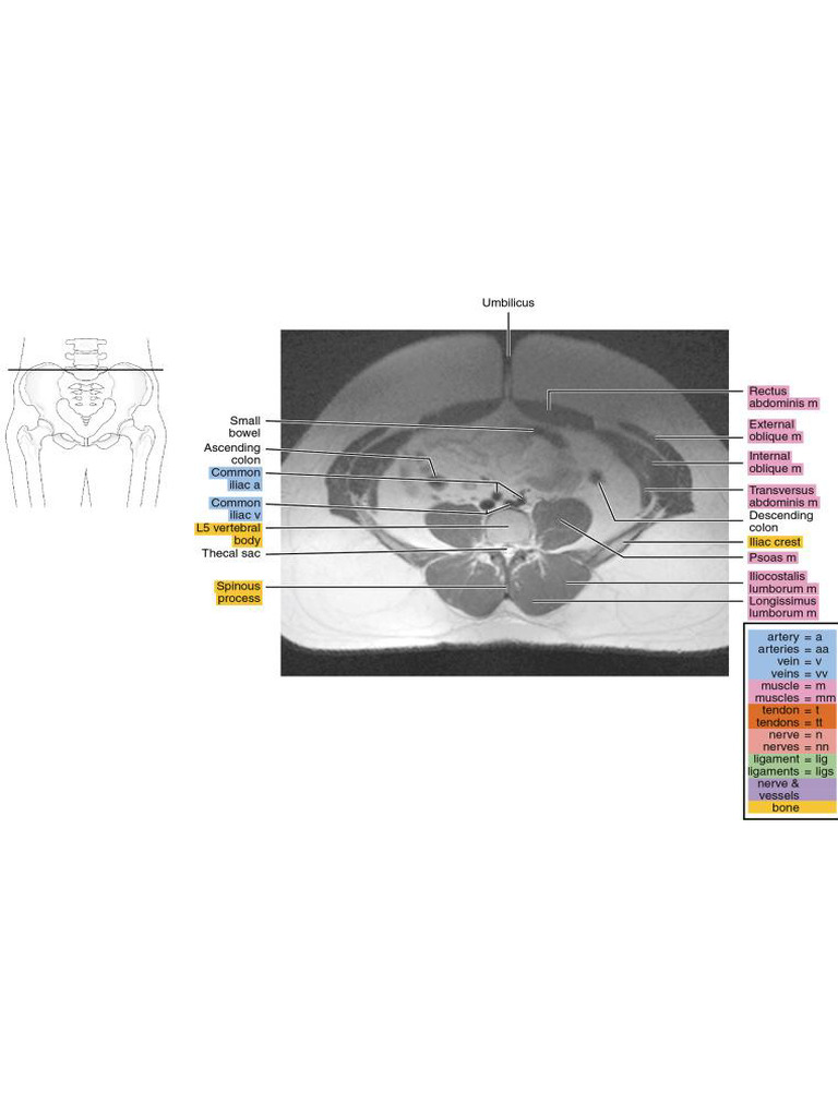 MRi Male Pelvis Anatomy | PDF