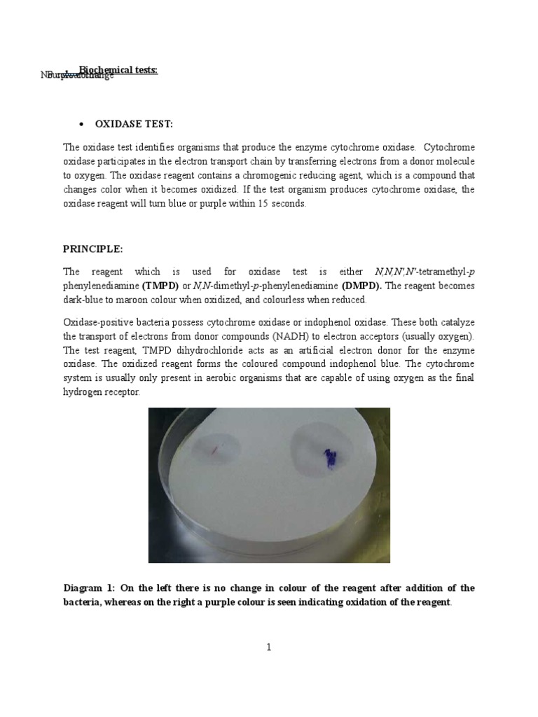 Biochemical Characterization of Bacteria Through Oxidative and Urease ...
