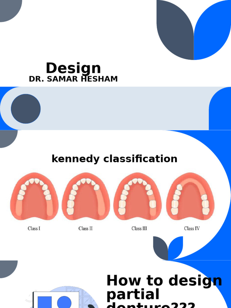 Designs of Removable Partial Denture | PDF
