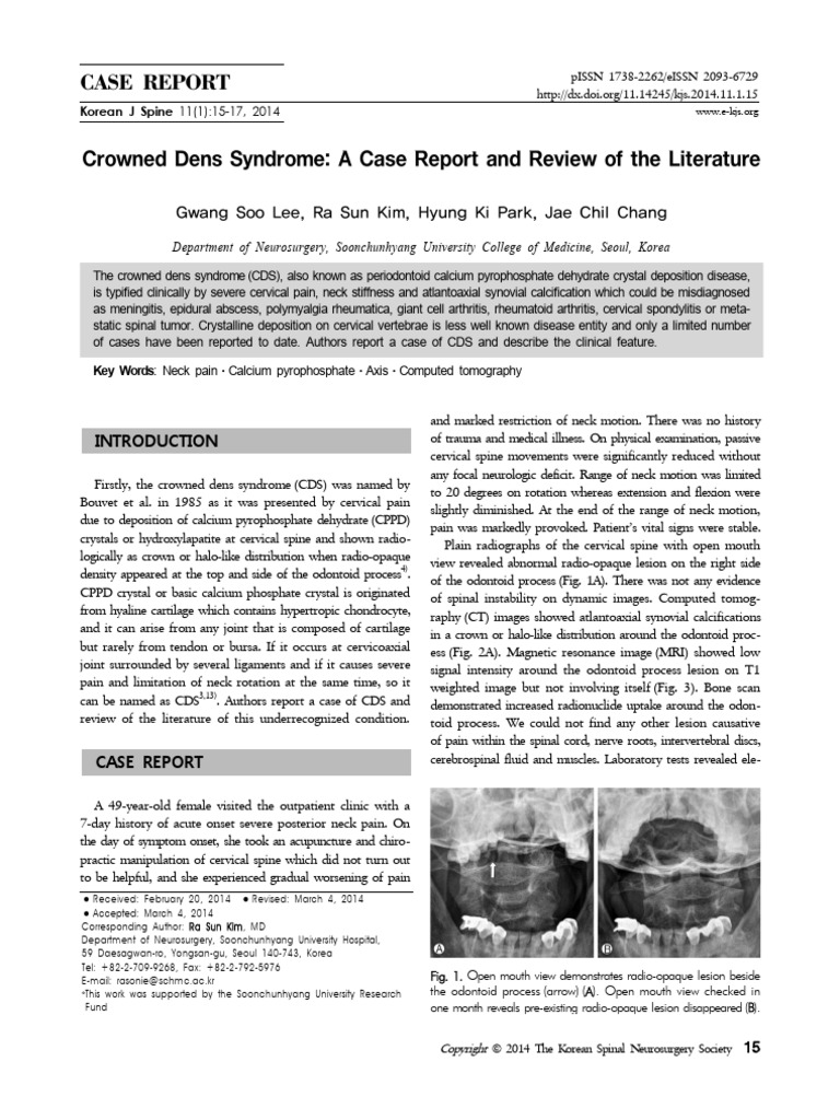 Crowned Dens Syndrome A Case Report and Review of The Literature | PDF ...
