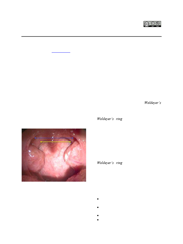 Paediatric Tonsillectomy | PDF | Lymphatic System | Medical Specialties