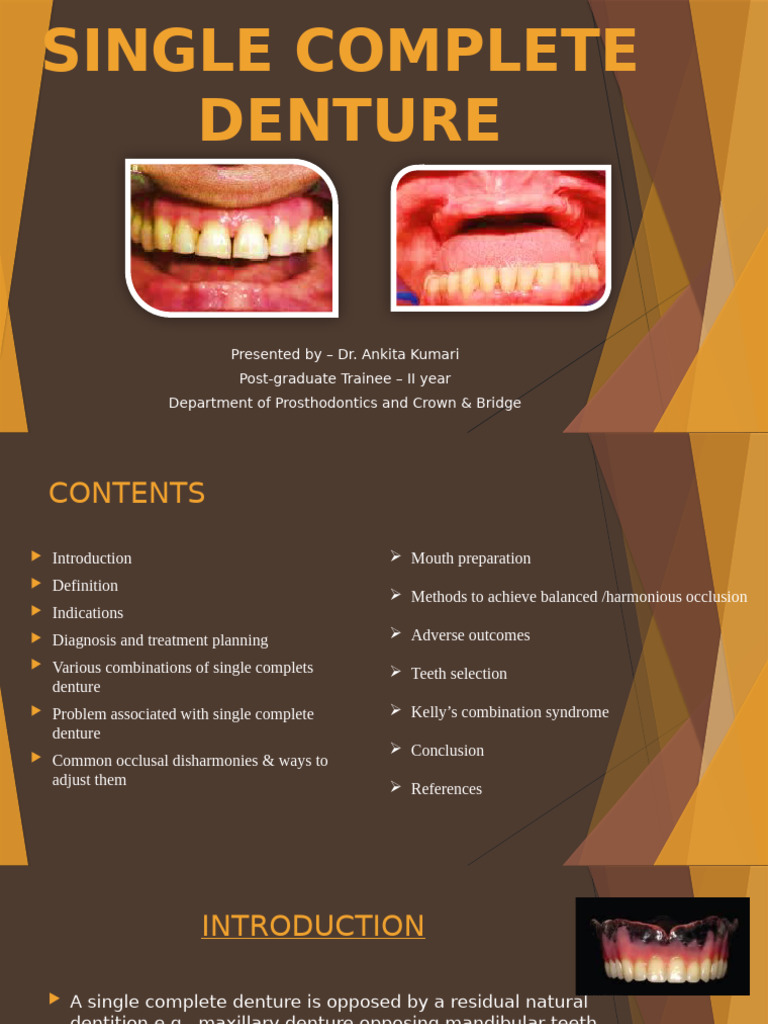 Single Complete Denture | PDF | Dentures | Medical Specialties