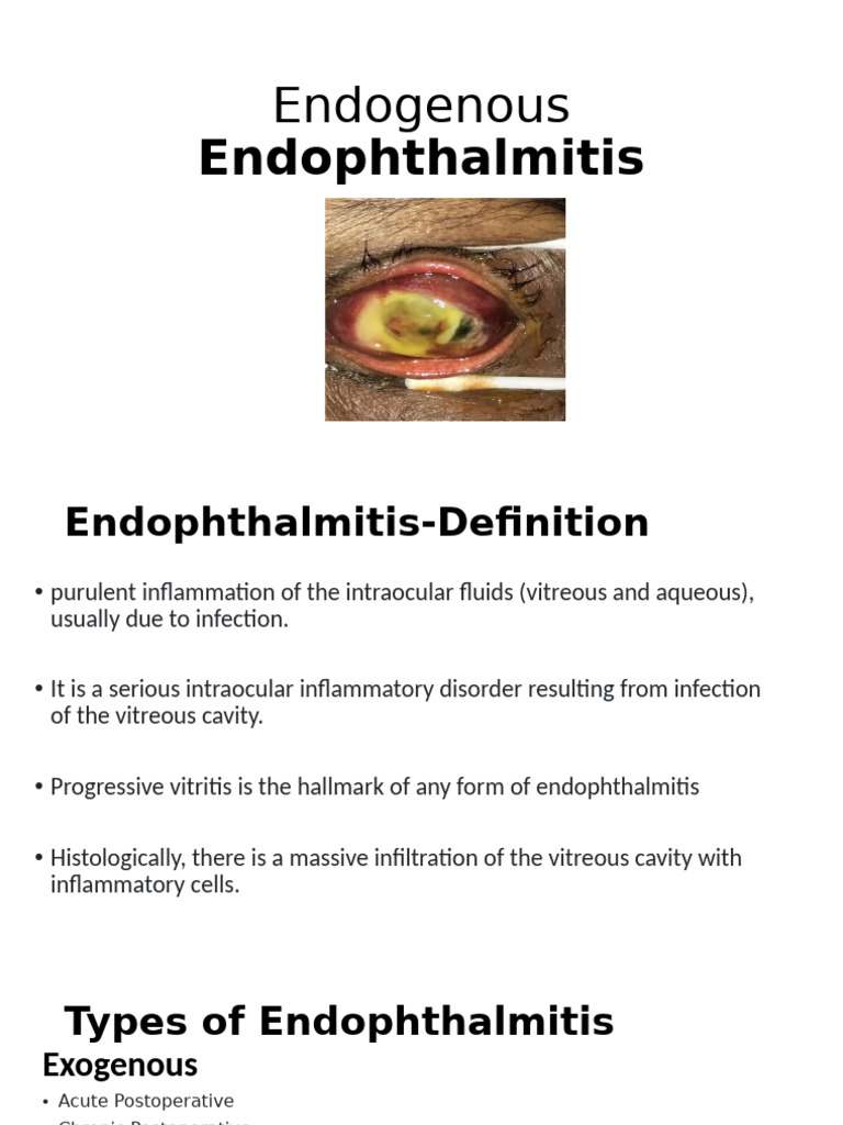 Endogenous Endopthamitis | PDF | Infection | Human Eye