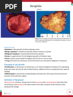 Endophytic vs Exophytic Tumors Explained | PDF