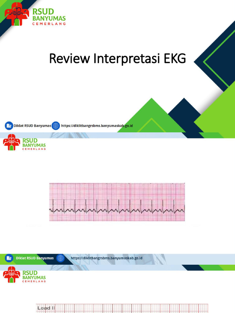 Review Interpretasi EKG | PDF