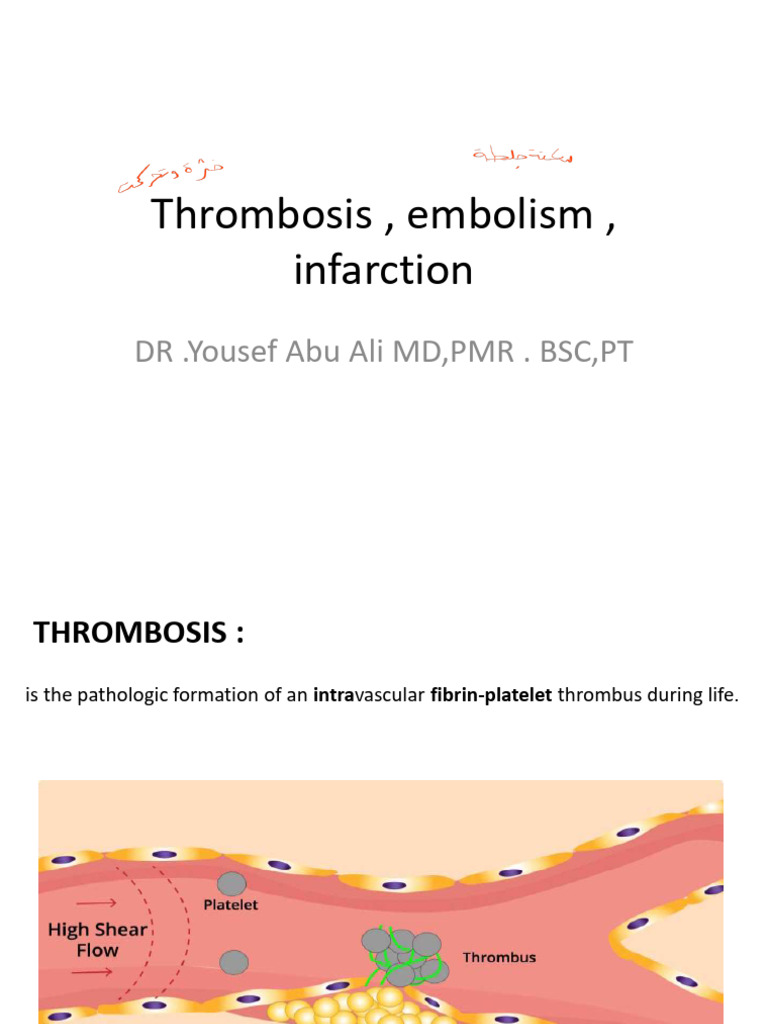 Thrmbosis, Embolism, Infarction | PDF | Embolism | Thrombus