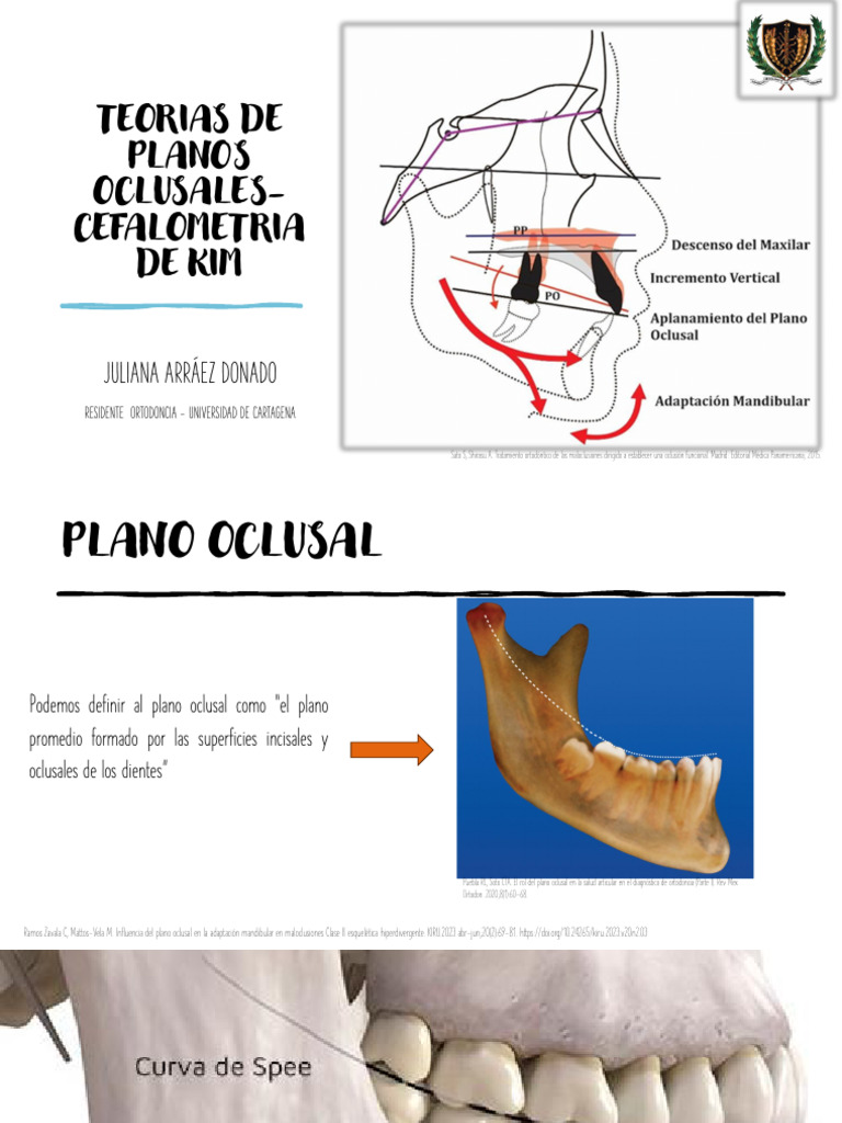 Teorias de Planos Oclusales - Cefalometria de Kim | PDF | Odontología | Nariz humana