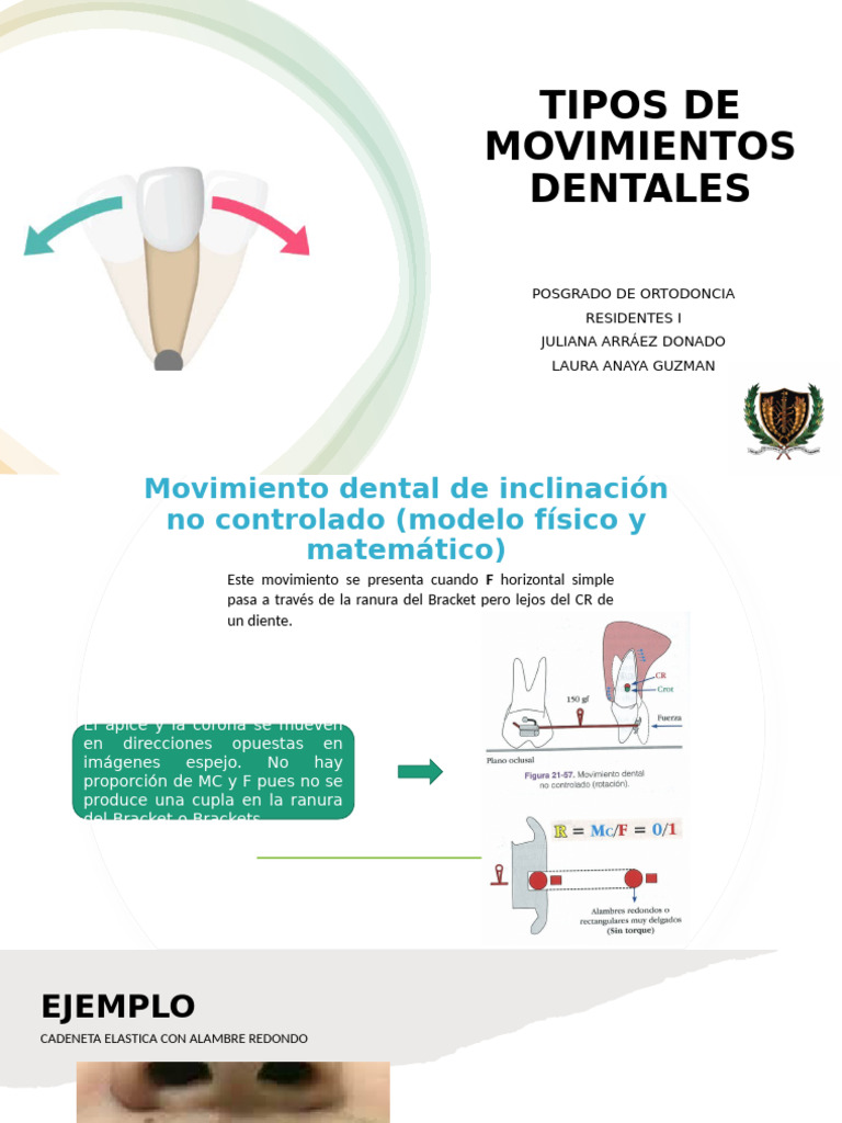 TIPOS DE MOVIMIENTOS DENTALES-con Videos | PDF | Fricción | Fuerza