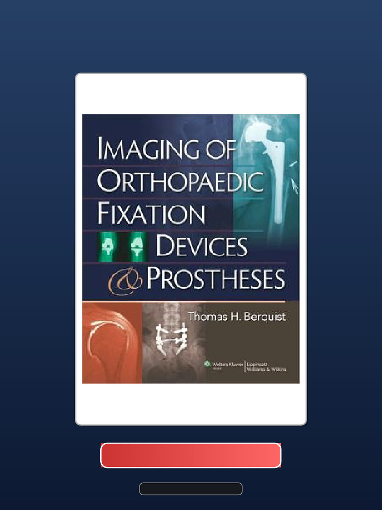 Imaging of Orthopaedic Fixation Devices and Prostheses Official Test ...