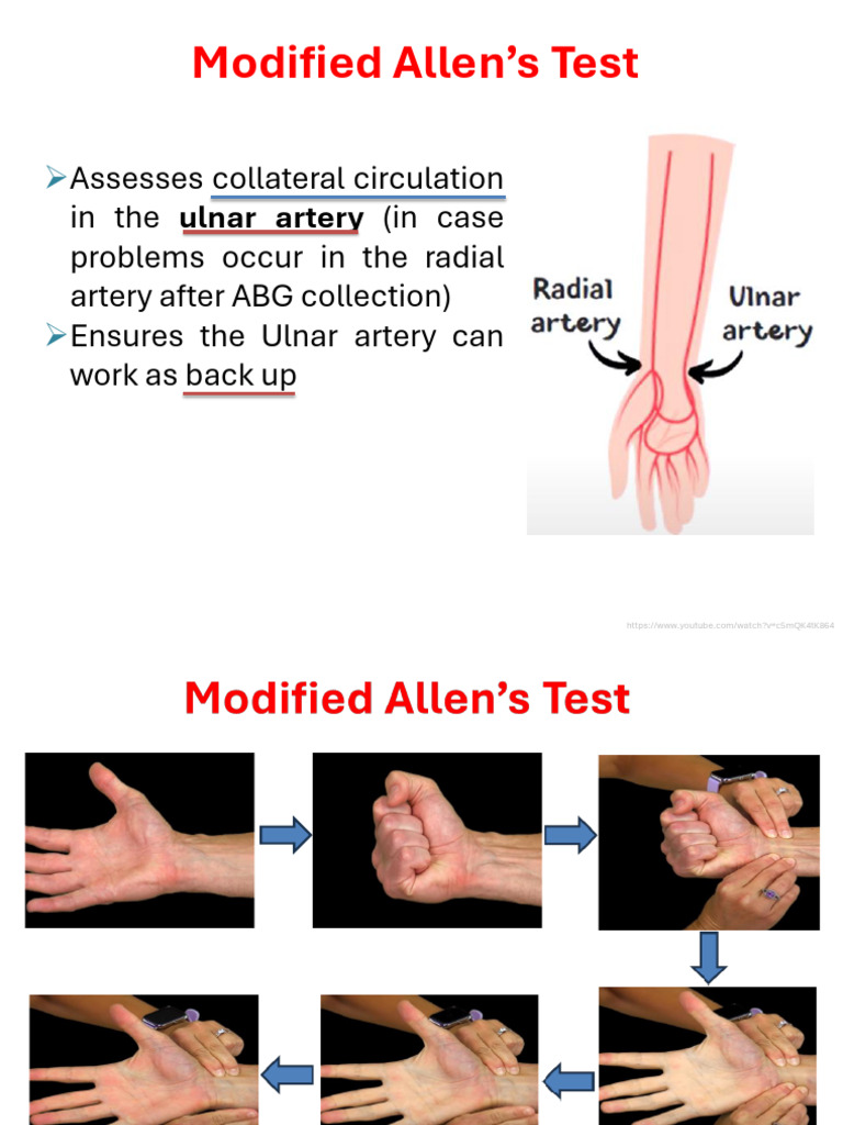 Allens Test | PDF