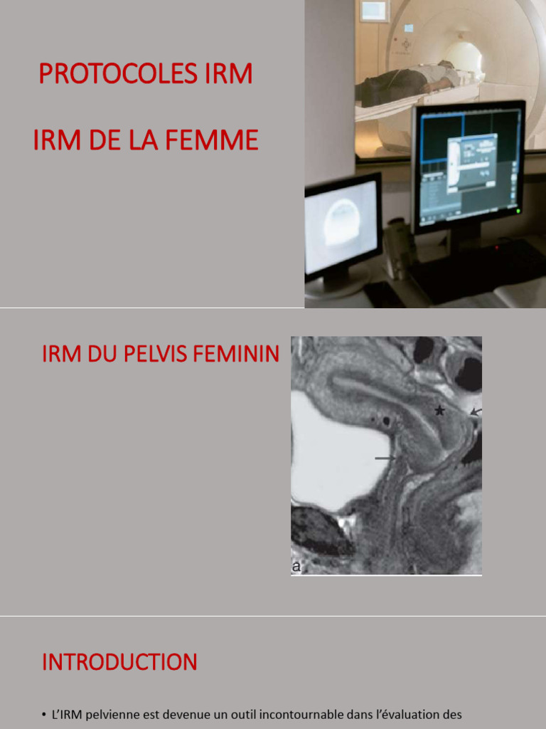 IRM Pelvienne : Évaluation Gynécologique | PDF | Utérus | Imagerie par ...