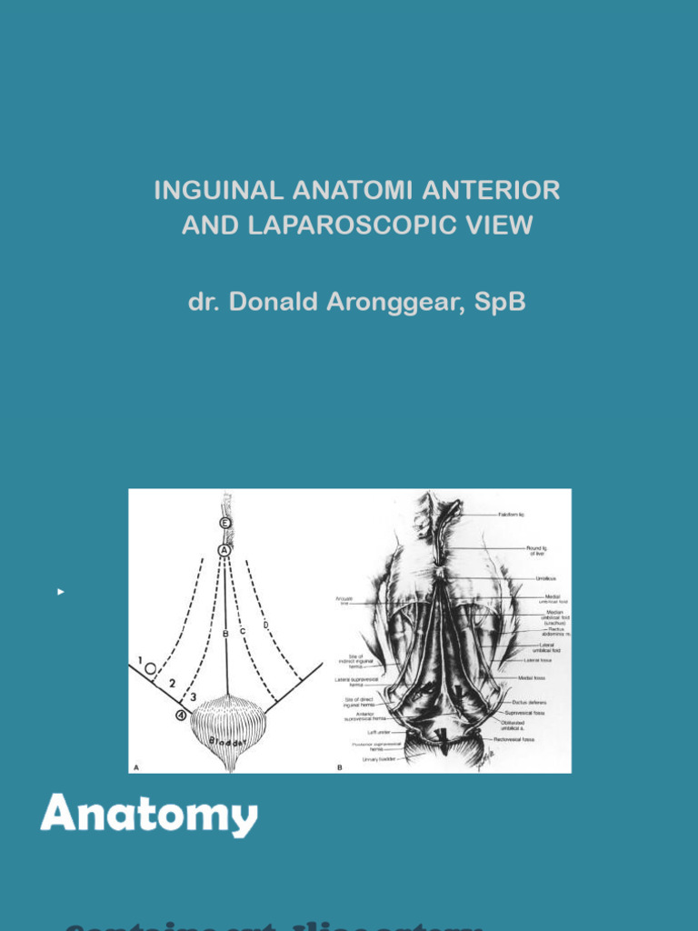 1. INGUINAL ANATOMI ANTERIOR AND LAPAROSCOPIC VIEW.pptx | PDF