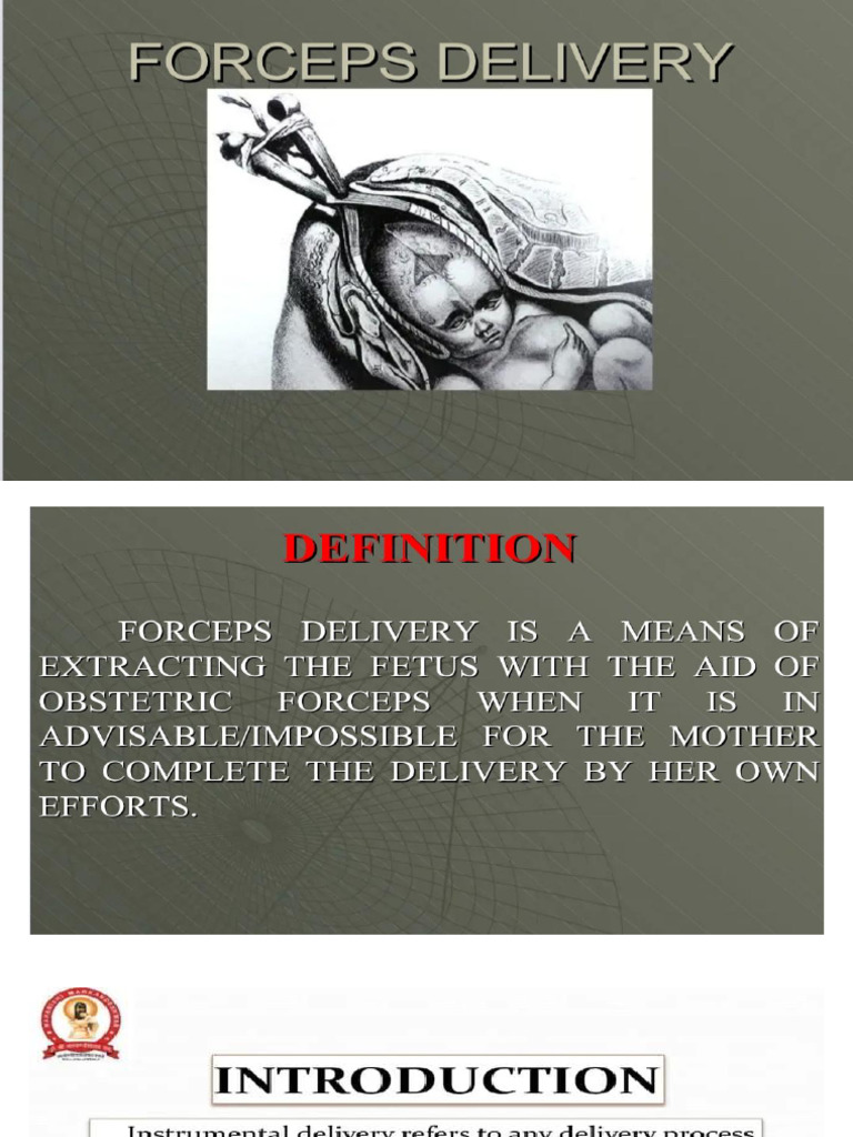 Forcep Delivery 1 | PDF