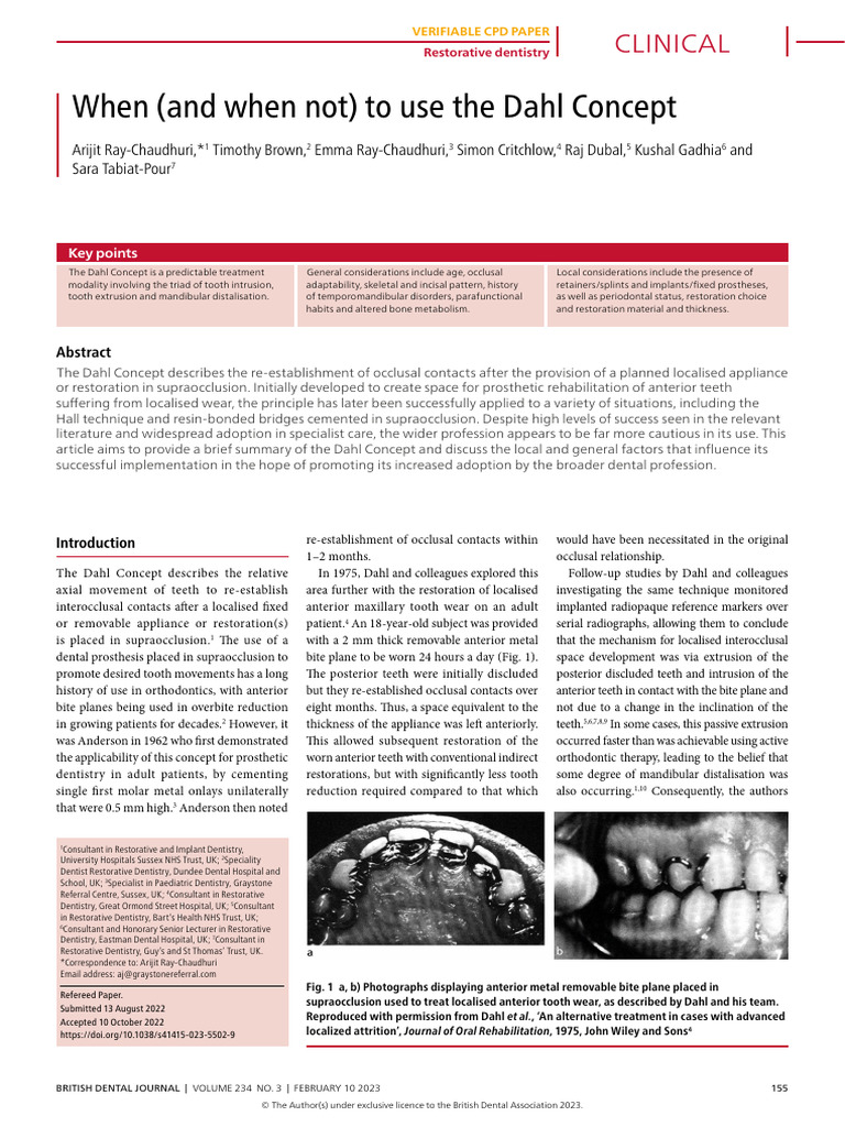 Dahls Princip | PDF | Dental Implant | Orthodontics