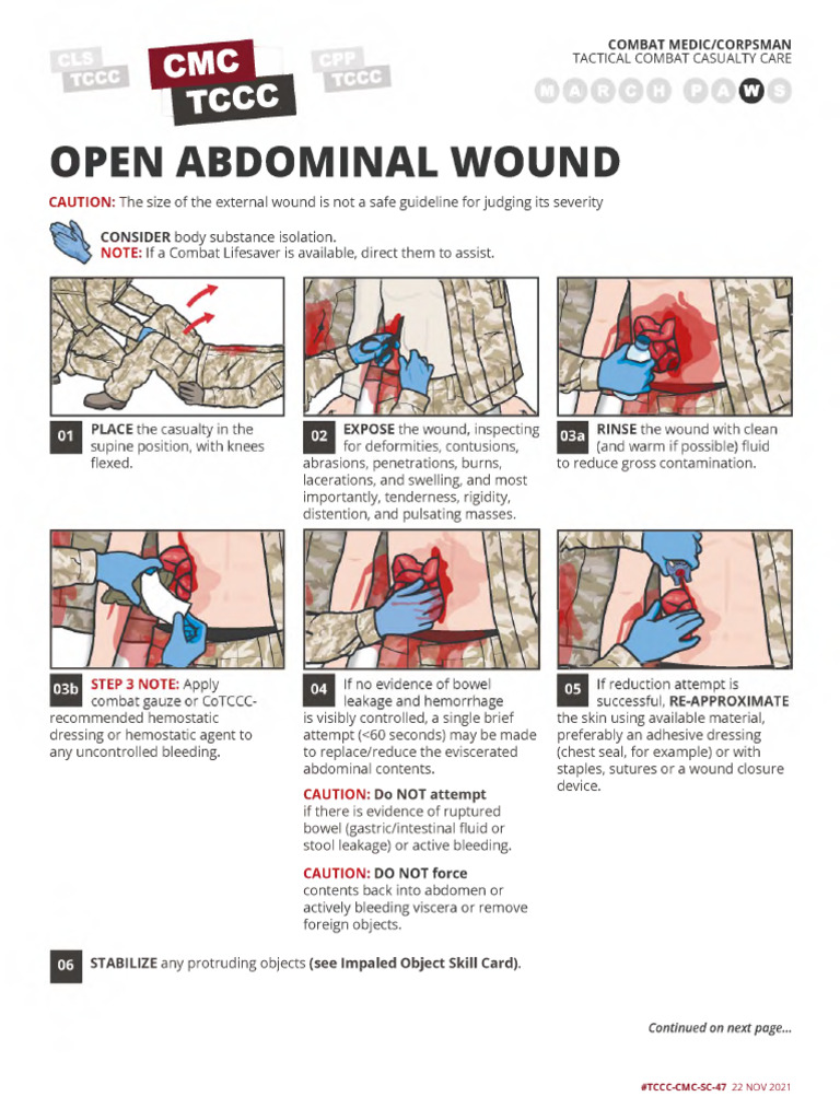 Skill Card Open Abdominal Wound en | PDF