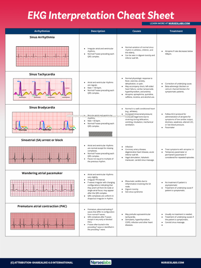EKG Interpretation Cheat Sheet For Heart Arrhythmias Nurseslabs 2 | PDF
