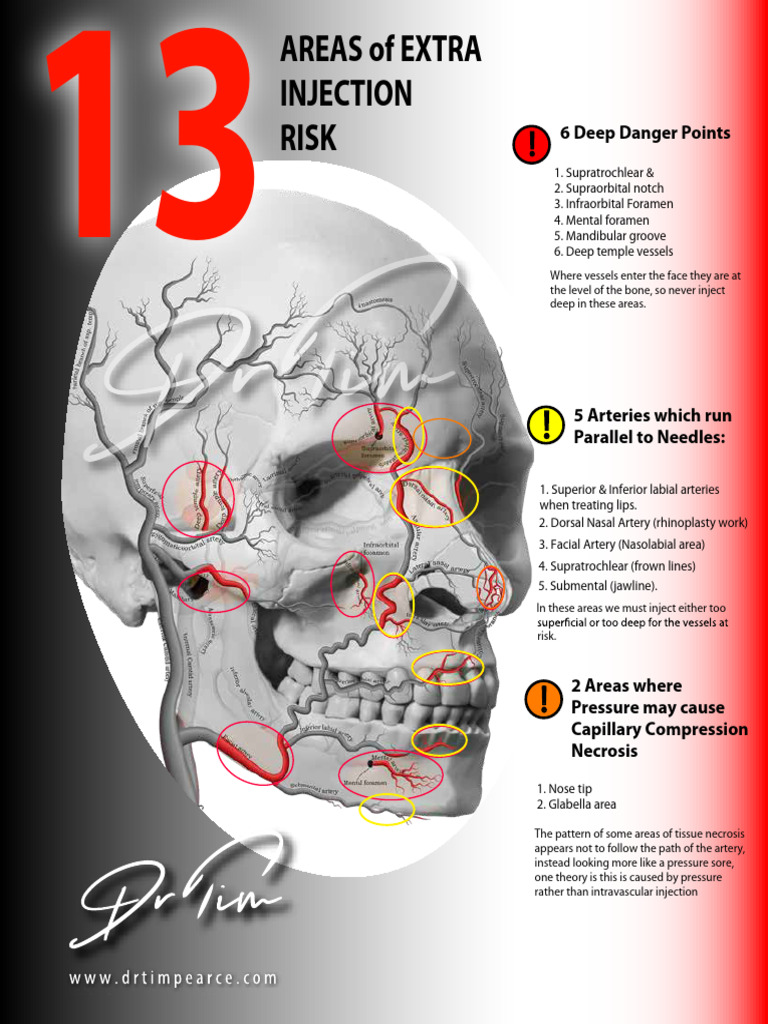 13 Areas With Extra Injection Risk | PDF