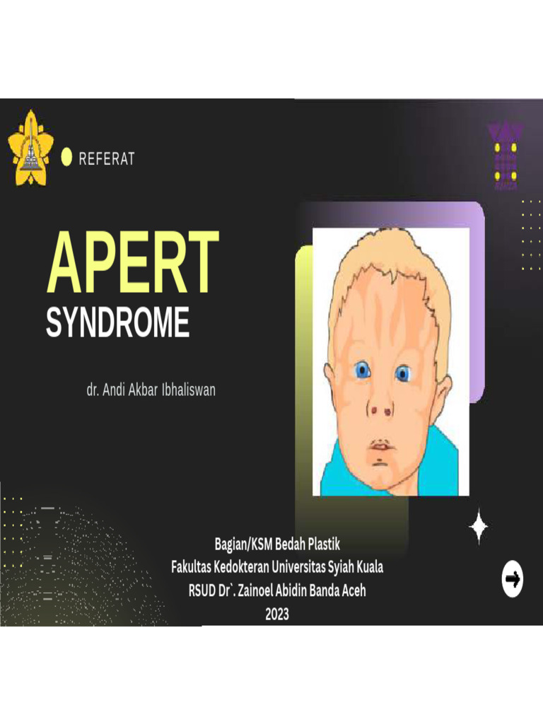 Apert Syndrome | PDF