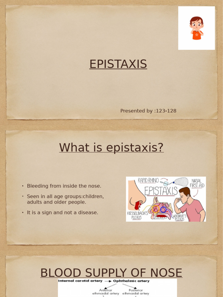 Ent Epistaxis (123-128) | PDF | Human Nose | Otorhinolaryngology