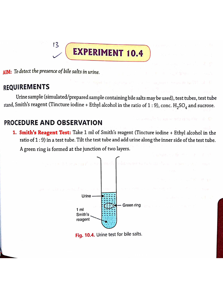 Test For Bile Salts in Urine | PDF
