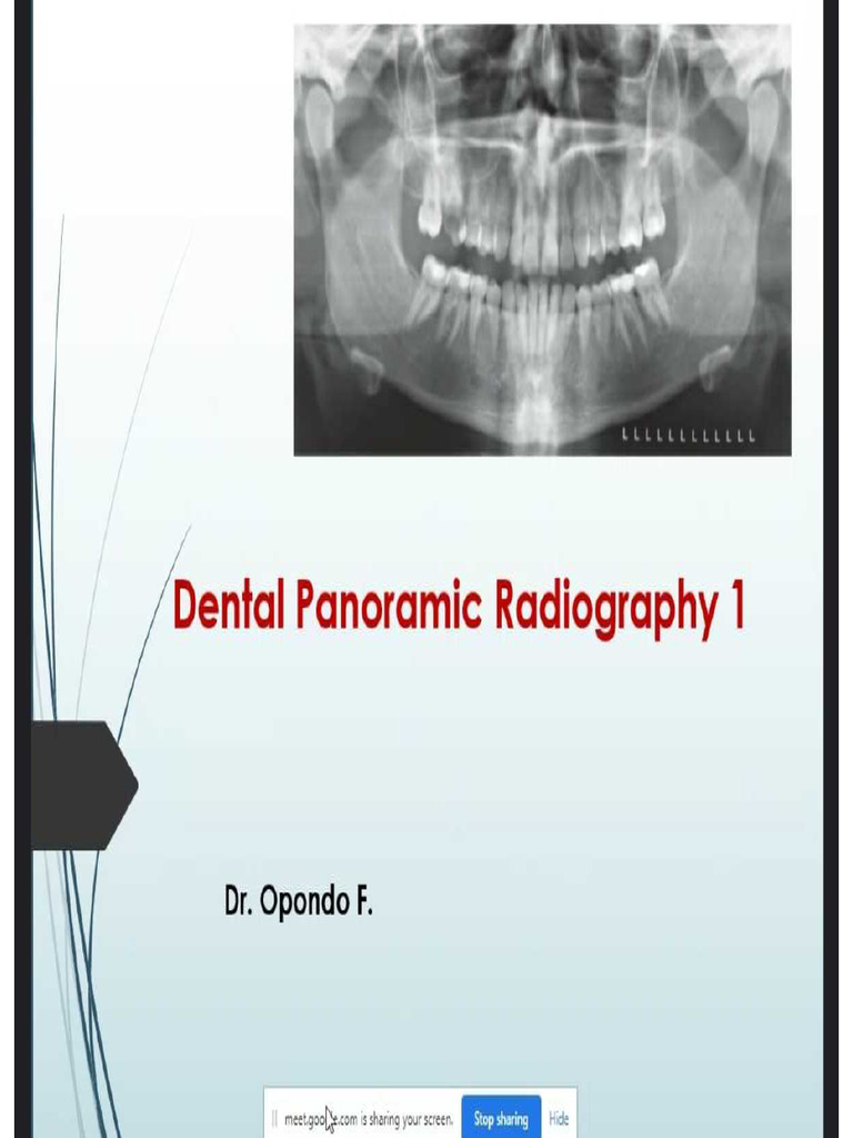 14. Dental Panoramic Radiology Dr Opondi | PDF