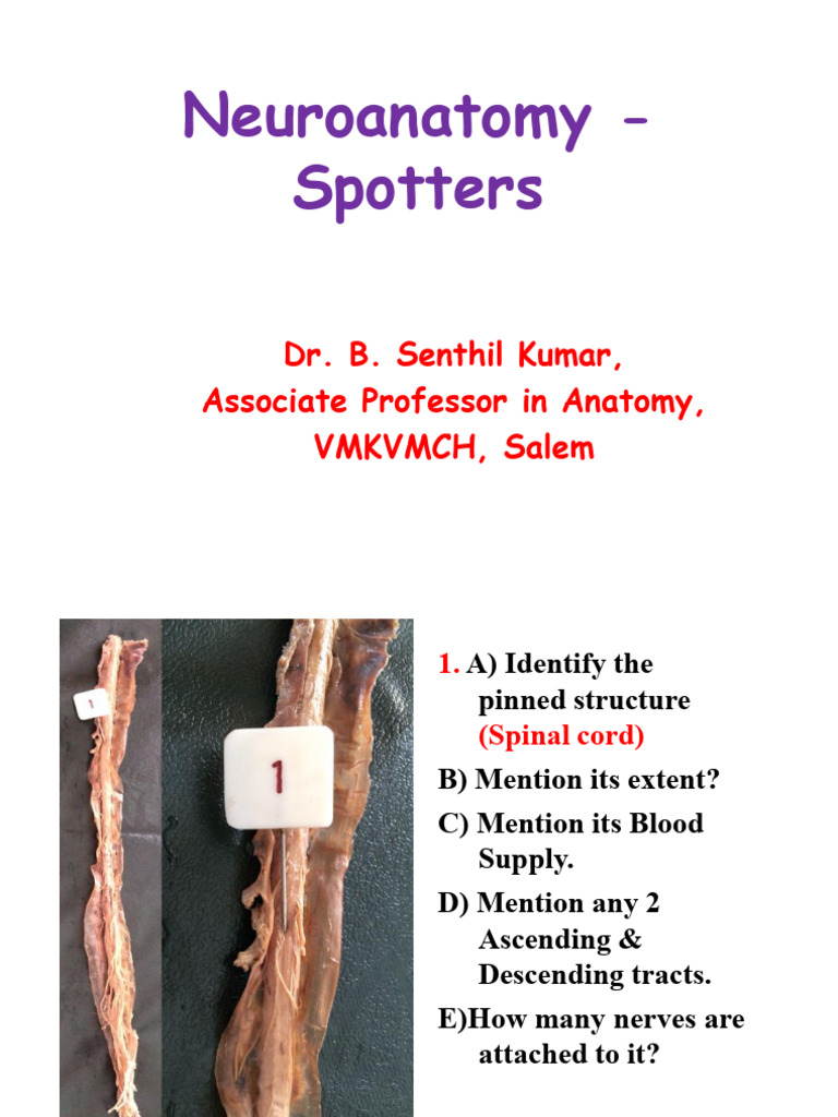Neuroanatomy Spotters With Answers | PDF | Spinal Cord | Neuroscience