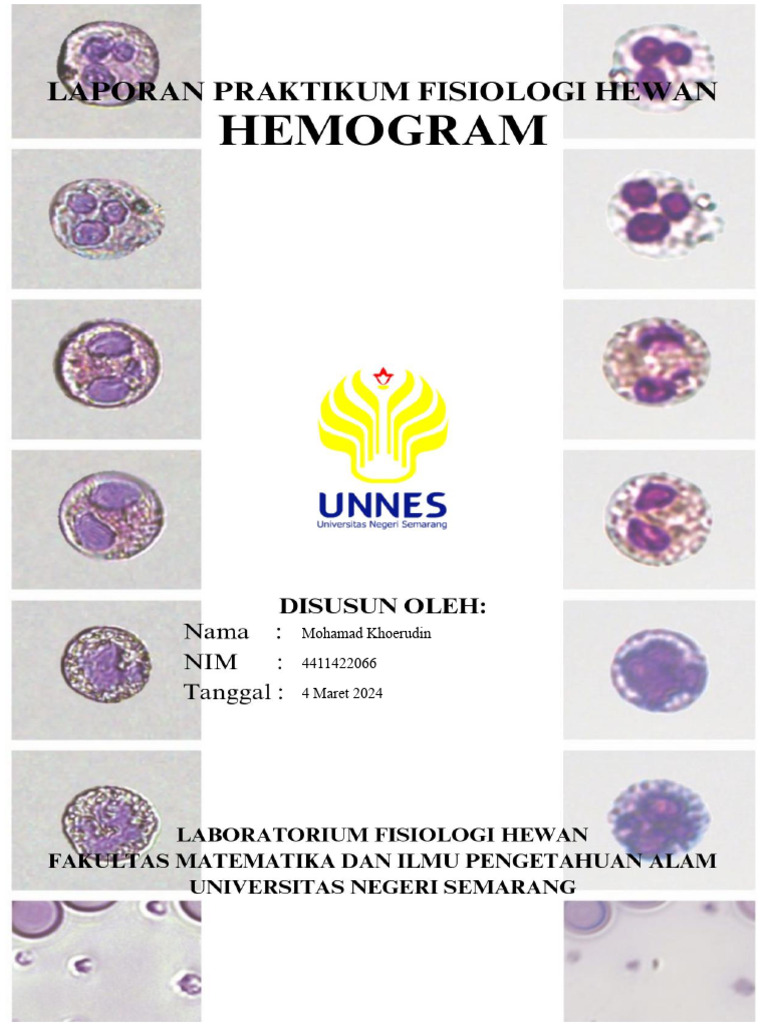 Analisis Jumlah dan Jenis Leukosit | PDF