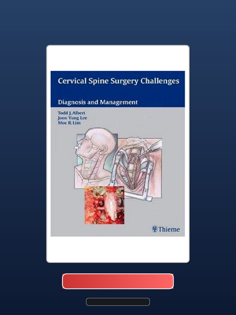 Cervical Spine Surgery Challenges Diagnosis and Management Official ...