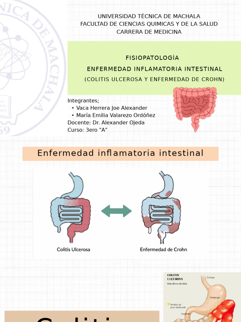 Colitis Ulcerosa y Enfermedad de Crohn Actual | PDF | Colitis ulcerosa ...