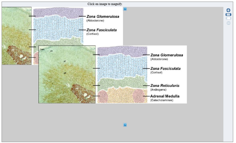 Figure 3. - Double Immunostained Cross-Section of A Human Adrenal Gland ...