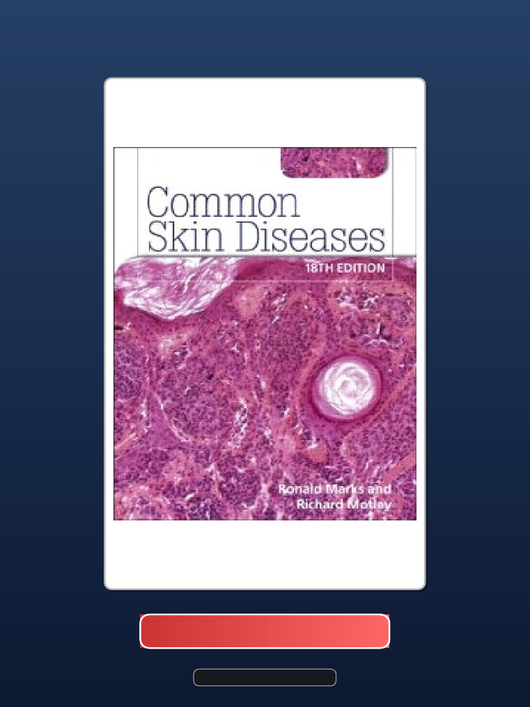 Common Skin Diseases 18th Official Test Bank | PDF | Multiple Choice ...