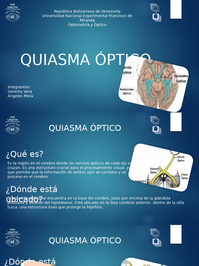 Quiasma Optico | PDF | Glándula pituitaria | Percepción visual