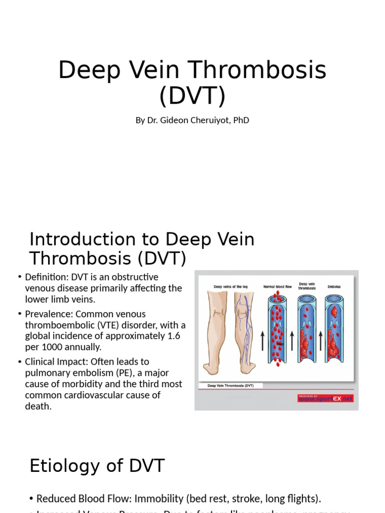 Deep Vein Thrombosis (DVT) | PDF | Thrombosis | Vein