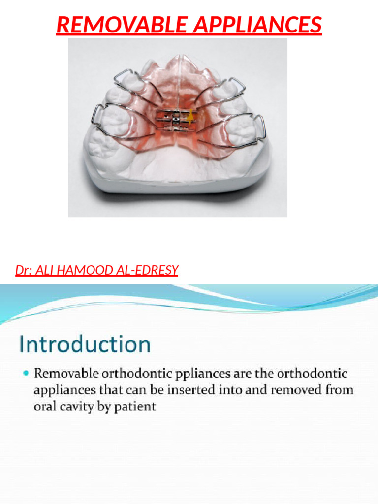 Removable Appliances | PDF
