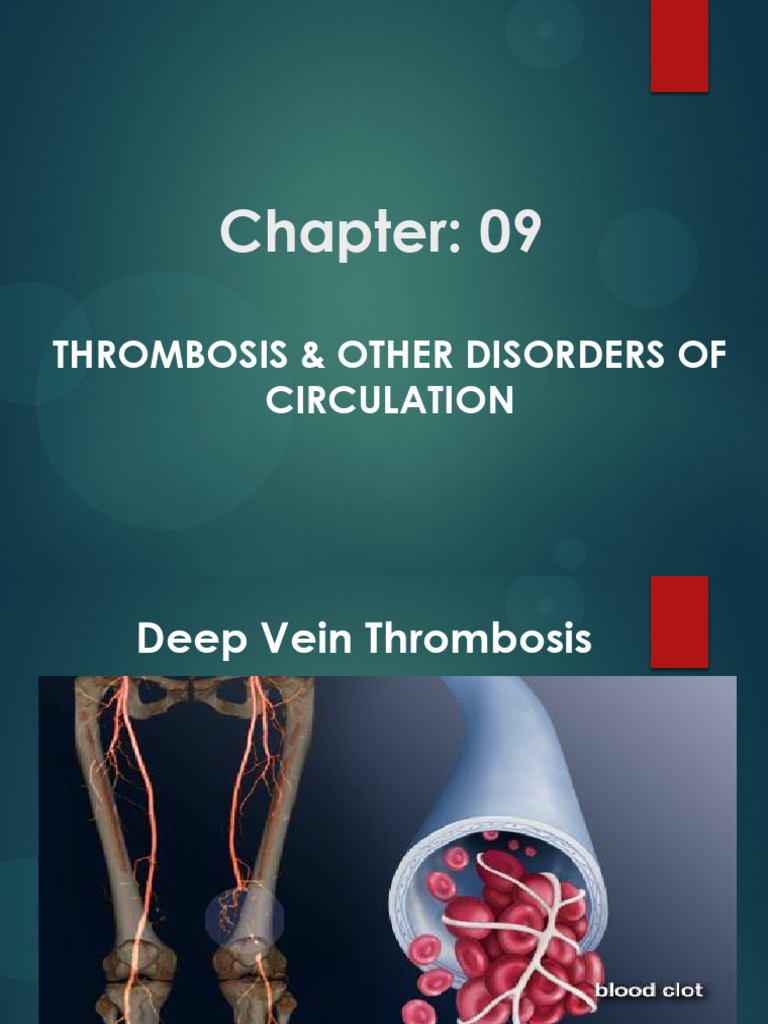 Deep Vein Thrombosis Overview and Complications | PDF | Coagulation | Vein
