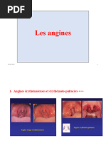 Les Phlegmons Peri-Amygdaliens - Cours 6ème Année | PDF | Spécialités ...