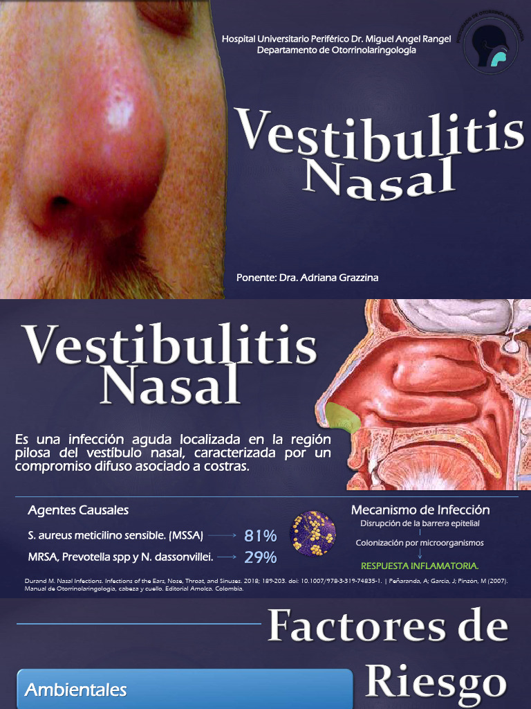 Tratamiento de la vestibulitis nasal | PDF | Medicina CLINICA ...