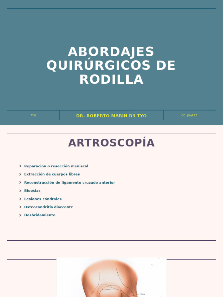 Abordajes QX Rodilla Roberto | PDF | Rodilla | Traumatologia