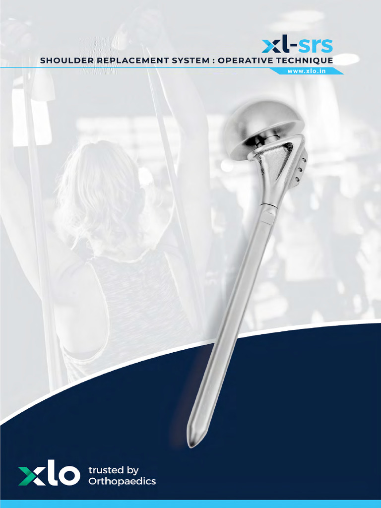 XL - Srs - Shoulder Replacement System-Operative Technique | PDF