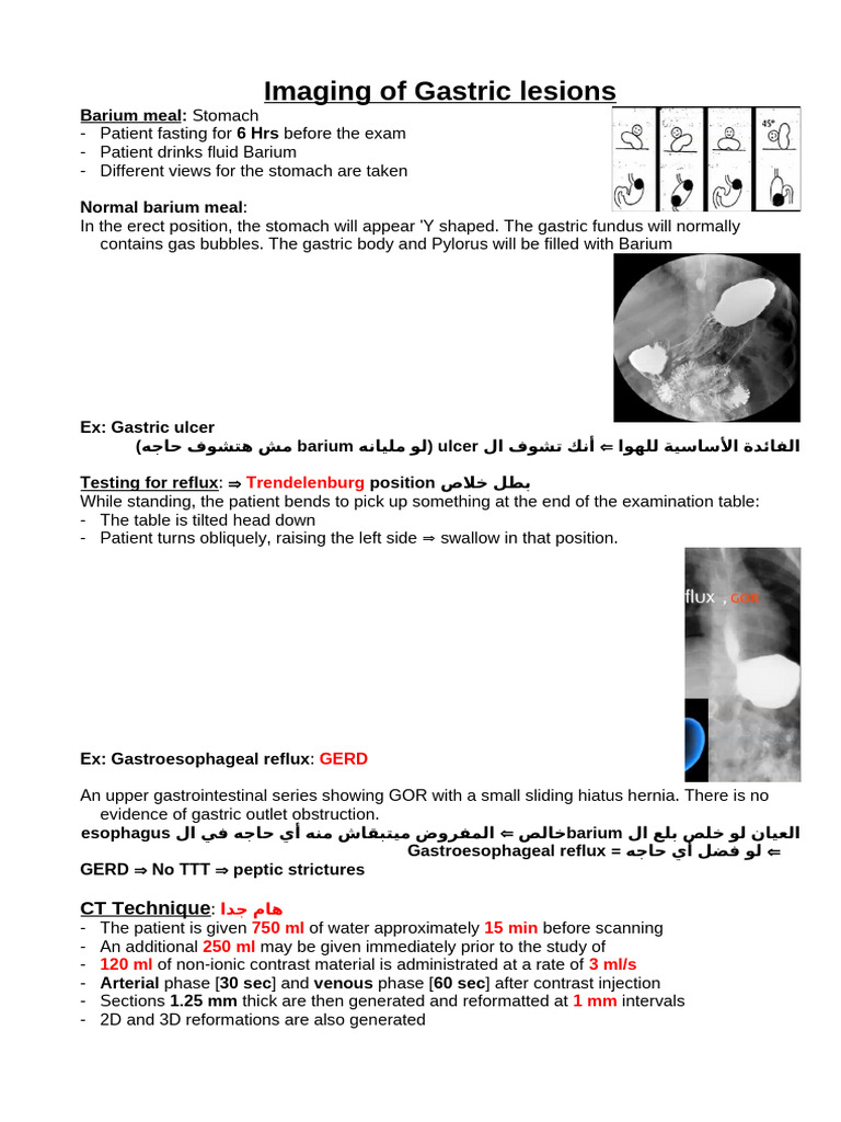 2 Imaging of Gastric Lesions | PDF | Stomach | Gastroesophageal Reflux ...