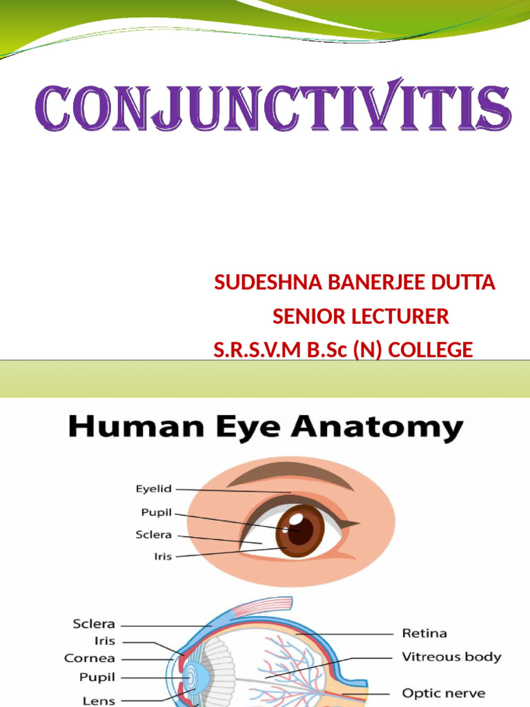Conjunctivitis Converted 210622164122 | PDF | Clinical Medicine | Human Diseases And Disorders