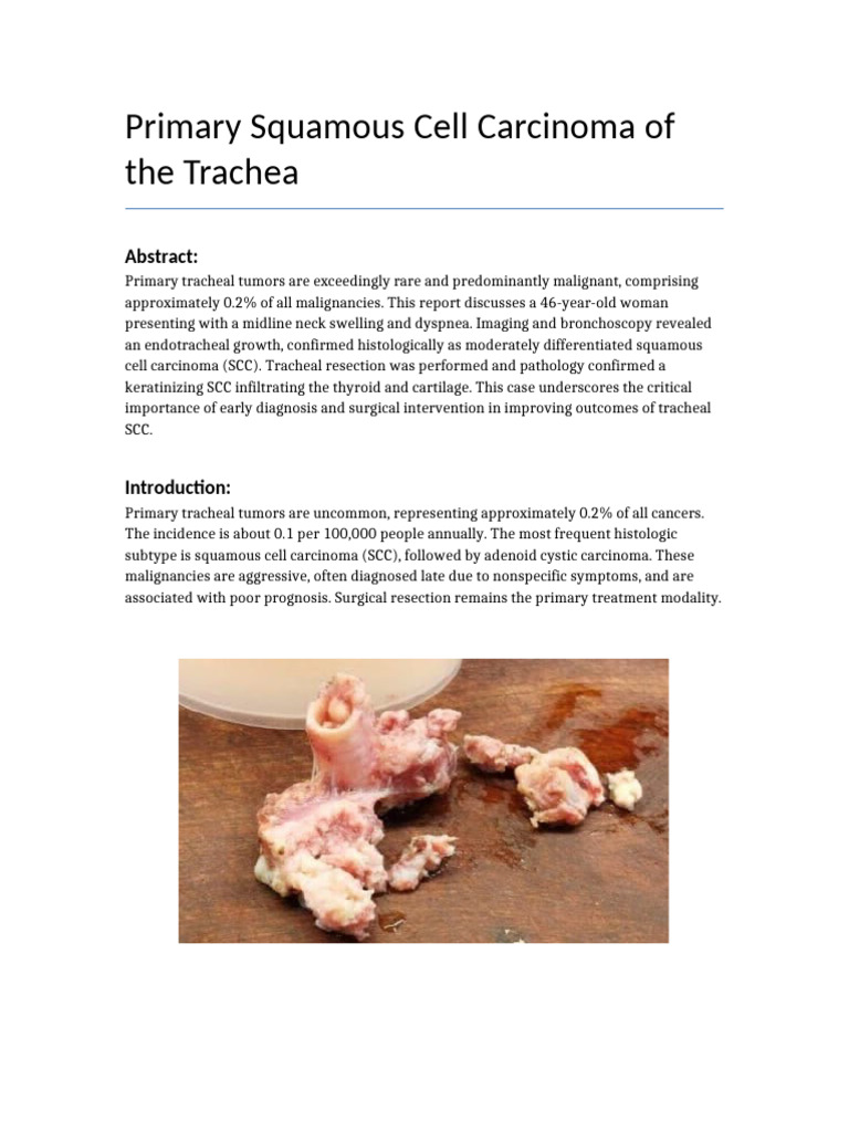 Primary Squamous Cell Carcinoma With Images | PDF | Carcinoma ...