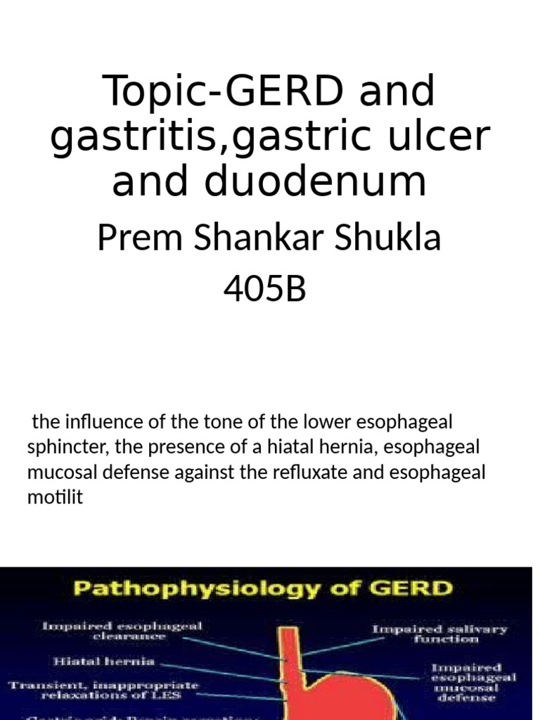 Topic GERD and WPS Office | PDF | Gastroesophageal Reflux Disease ...