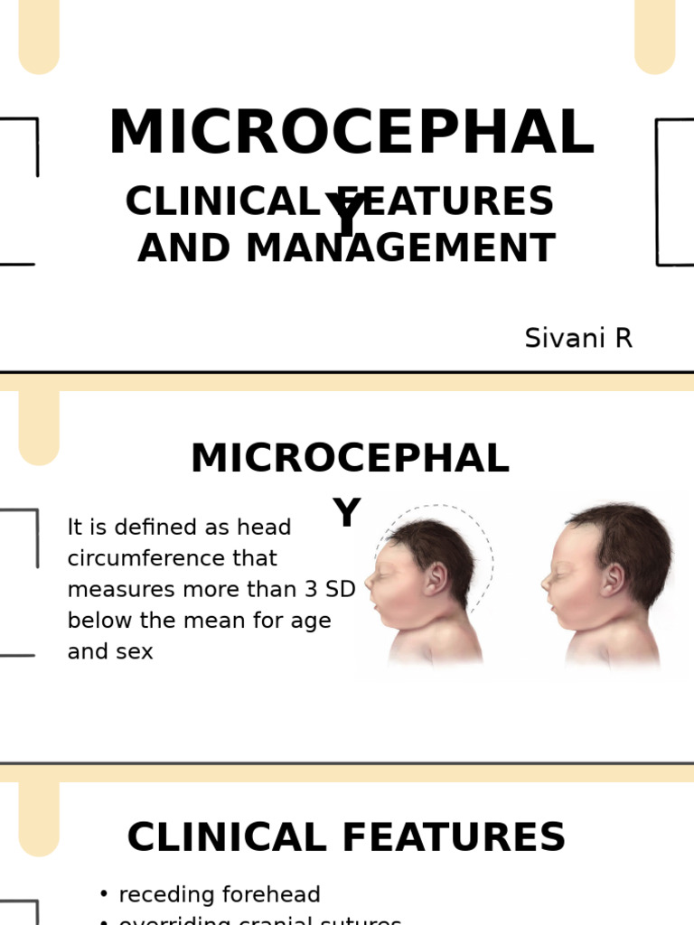 Microcephaly 20250708 190414 0000 | PDF