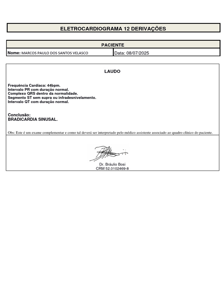 Laudo Ecg Marcos Paulo Dos Santos Velasco | PDF