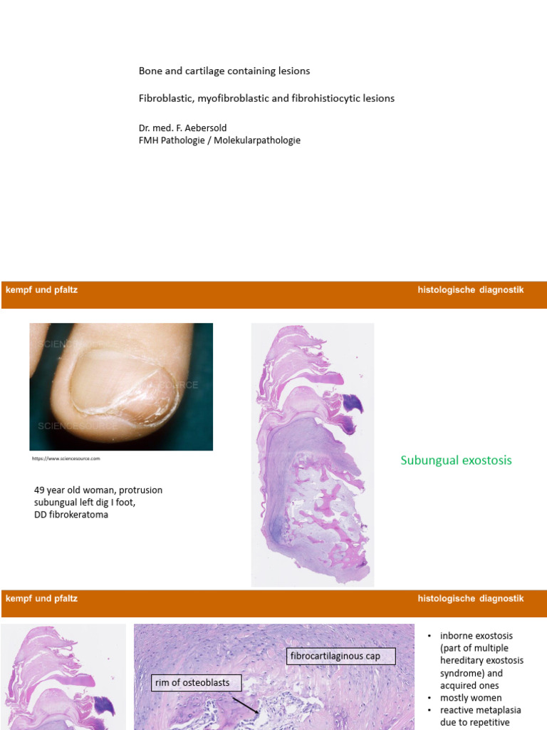Bone and Cartilage Lesions Overview | PDF | Bone | Neoplasms